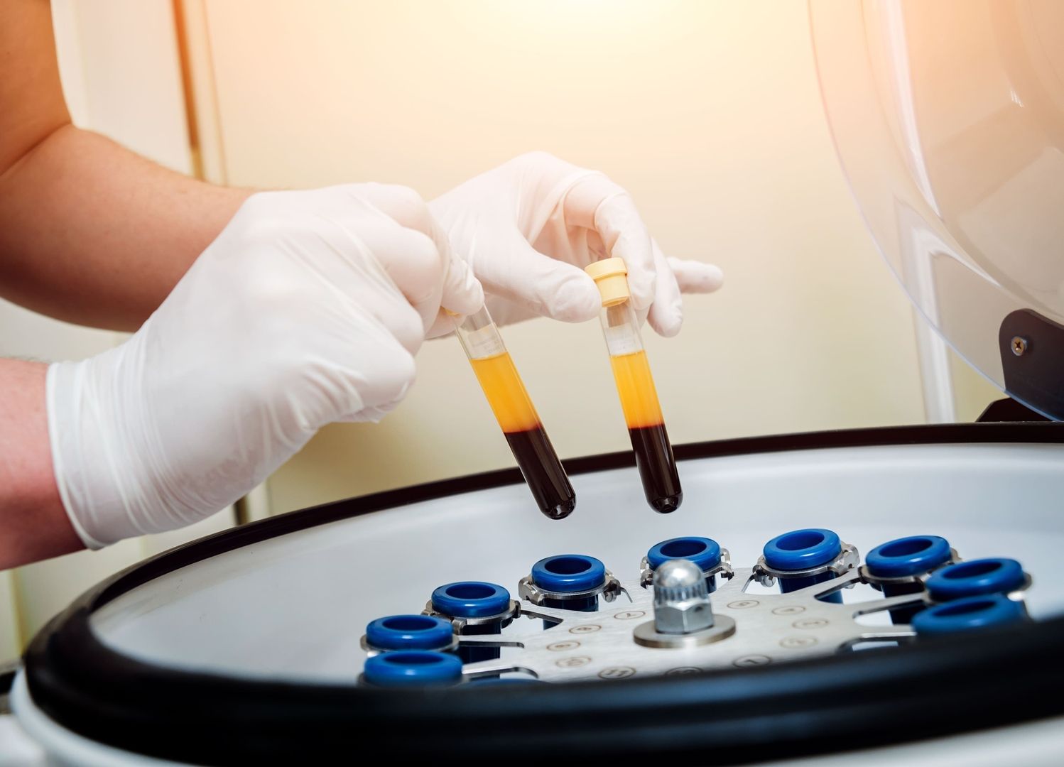 Blood and Tissue Processing | Vista Biologicals Services